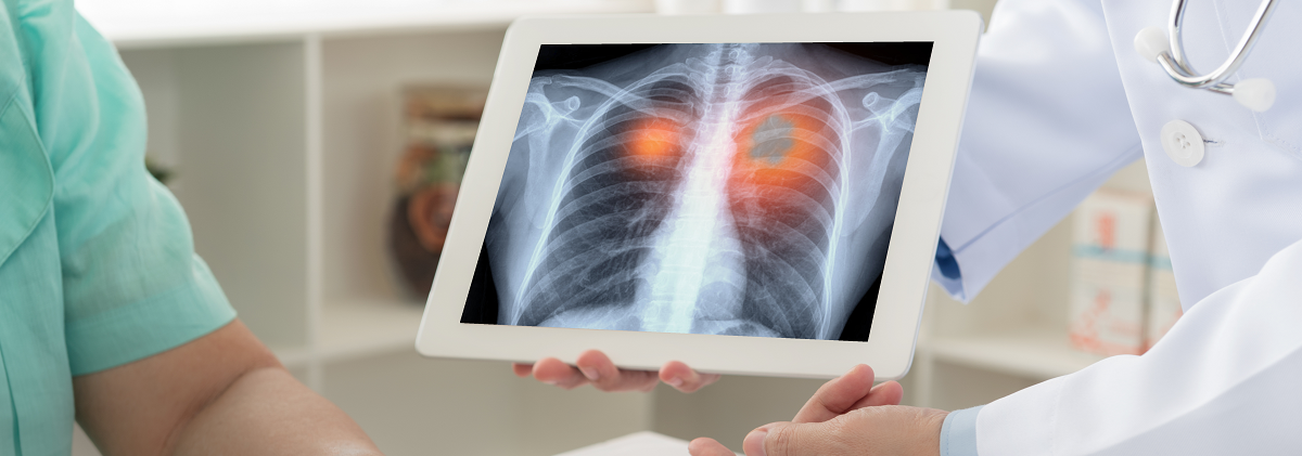 Radon and your health | Colorado Department of Public Health and ...